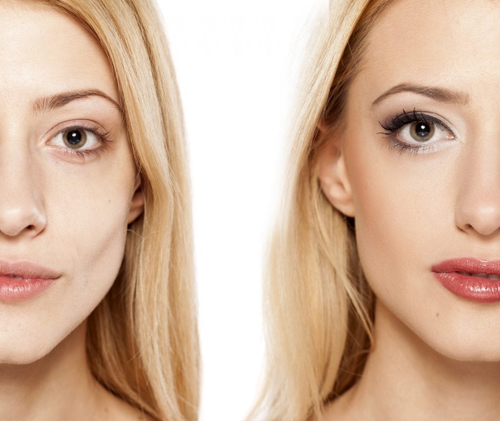 treatments face sculpting with dermal fillers | The London Facial Care