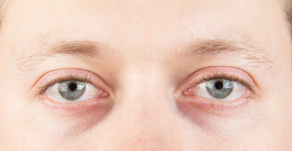 PRESERVATION OF THE PERIORBITAL REGION | The London Facial Care